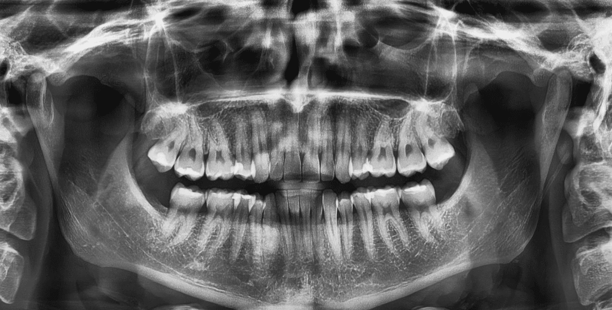 Pantomography - Skanai